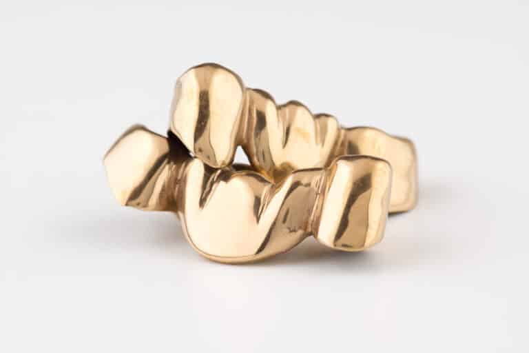 Or dentaire : prix de l'or dentaire au gramme